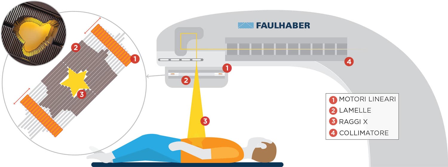 Multileaf collimators for radiotherapy - Servotecnica